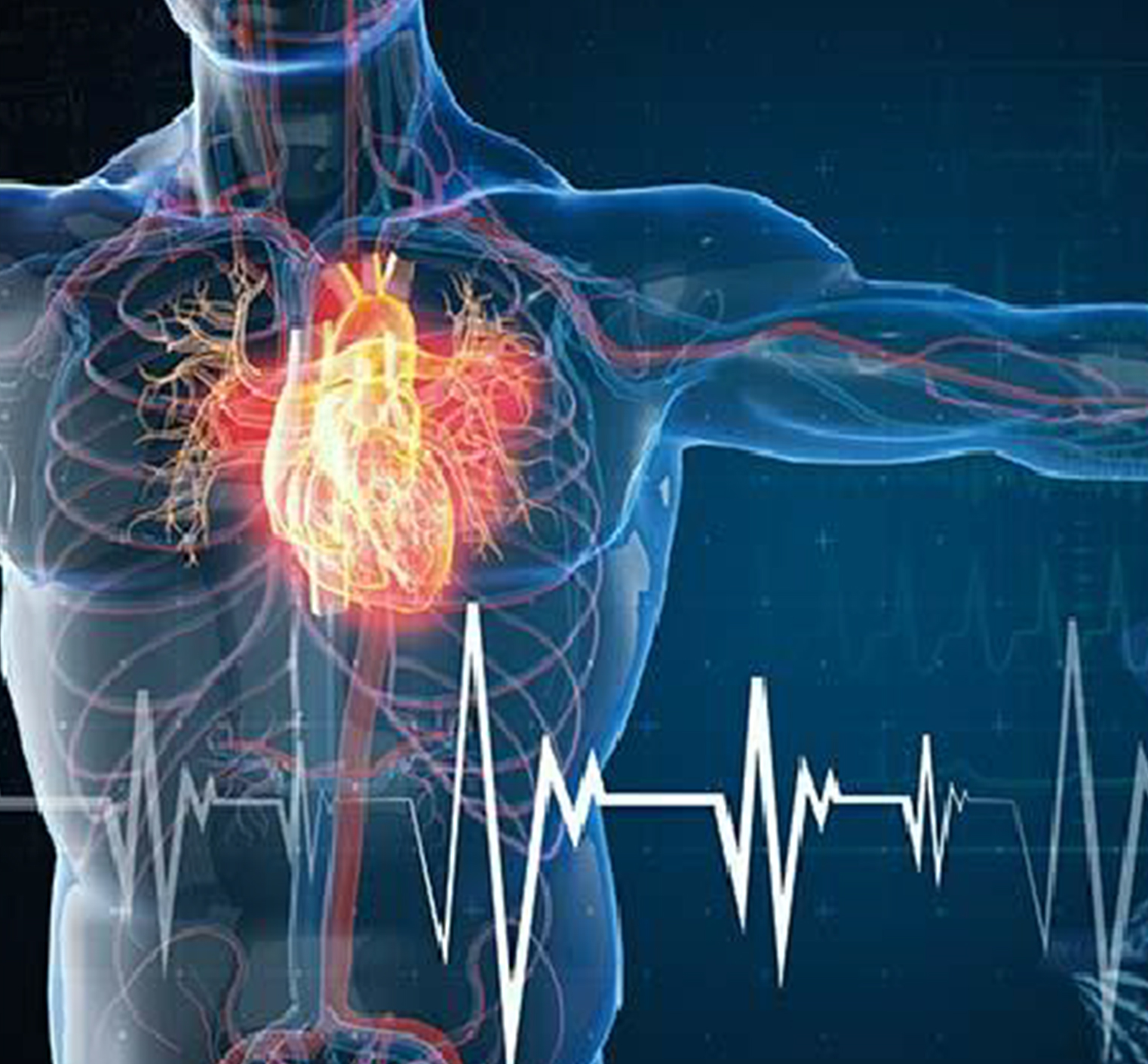 Cardiovascular Diseases